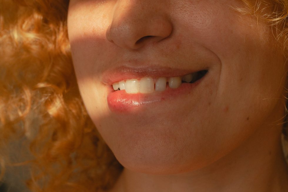 Stop Bleeding Gums: Expert Dental Tips